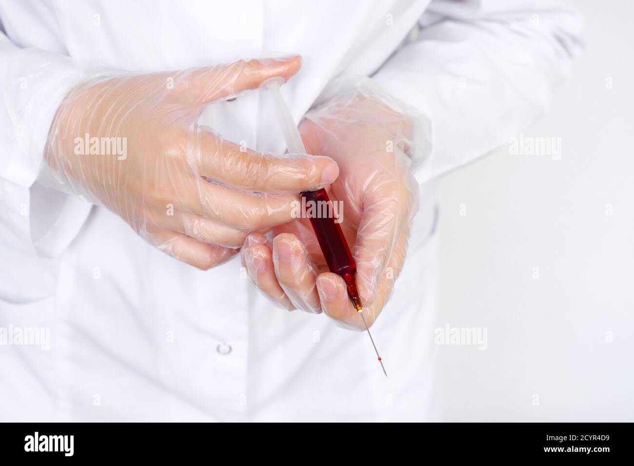 Doctor hand in a latex glove holds a syringe full of blood for analysis ...