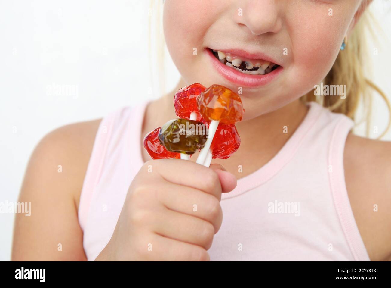 Child eats candy. Girl has caries on teeth Stock Photo - Alamy