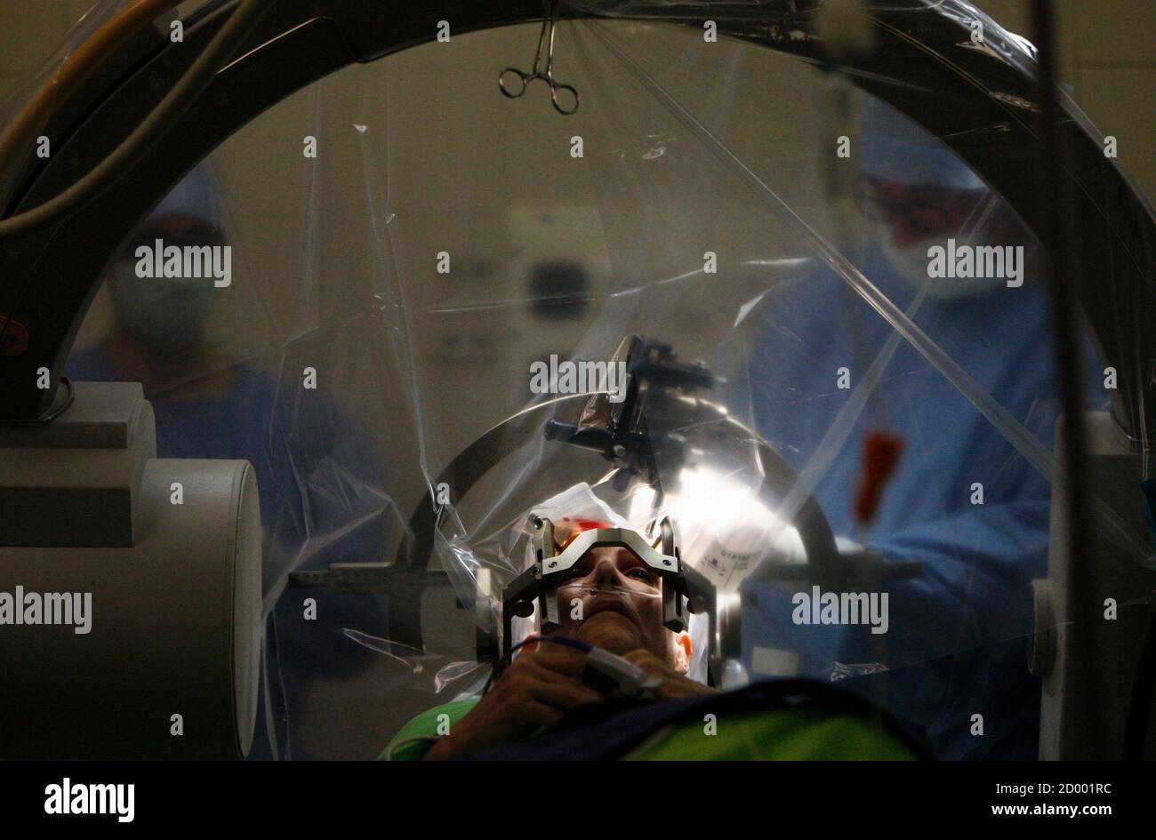 Awake surgery hi-res stock photography and images - Alamy