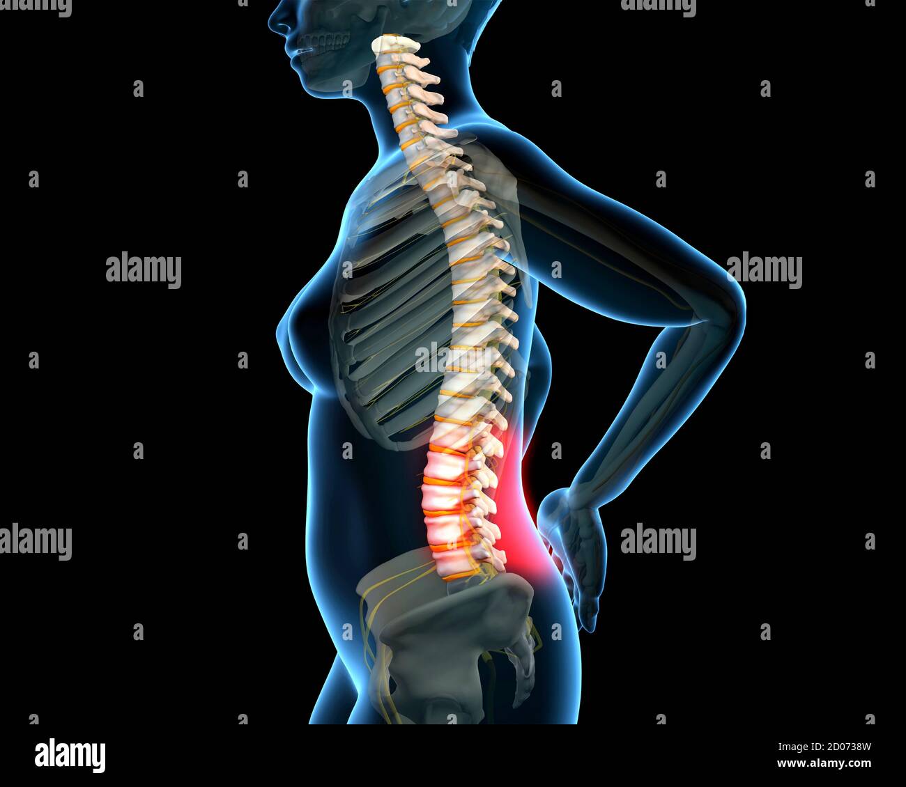 Lower back pain, illustration Stock Photo - Alamy