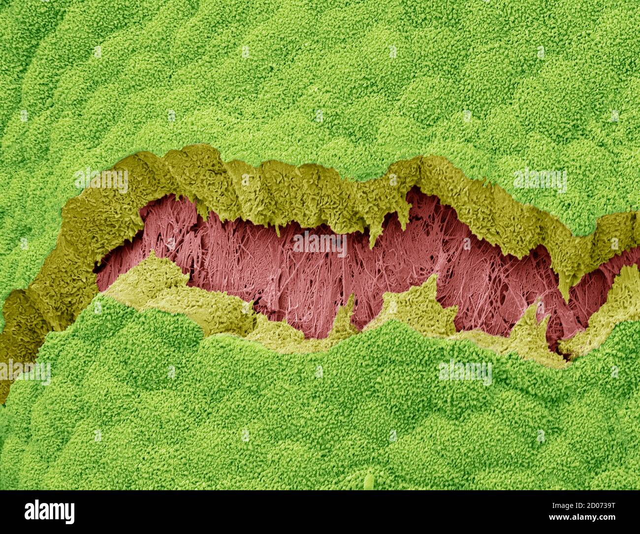 Gall bladder. Coloured scanning electron micrograph (SEM) of the ...