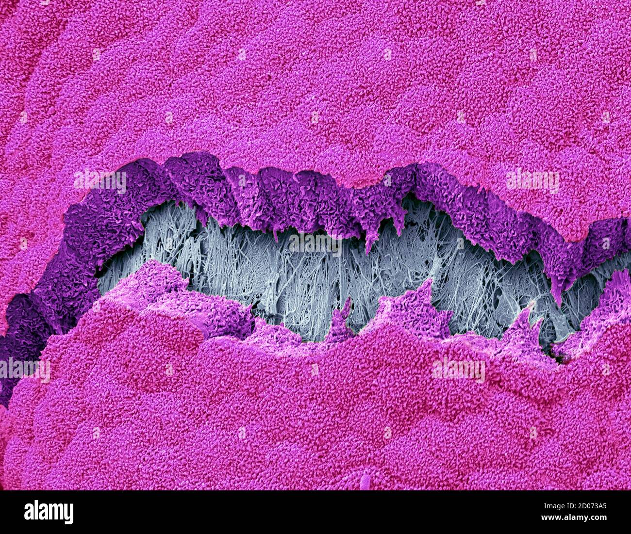 Bladder lining hi-res stock photography and images - Alamy