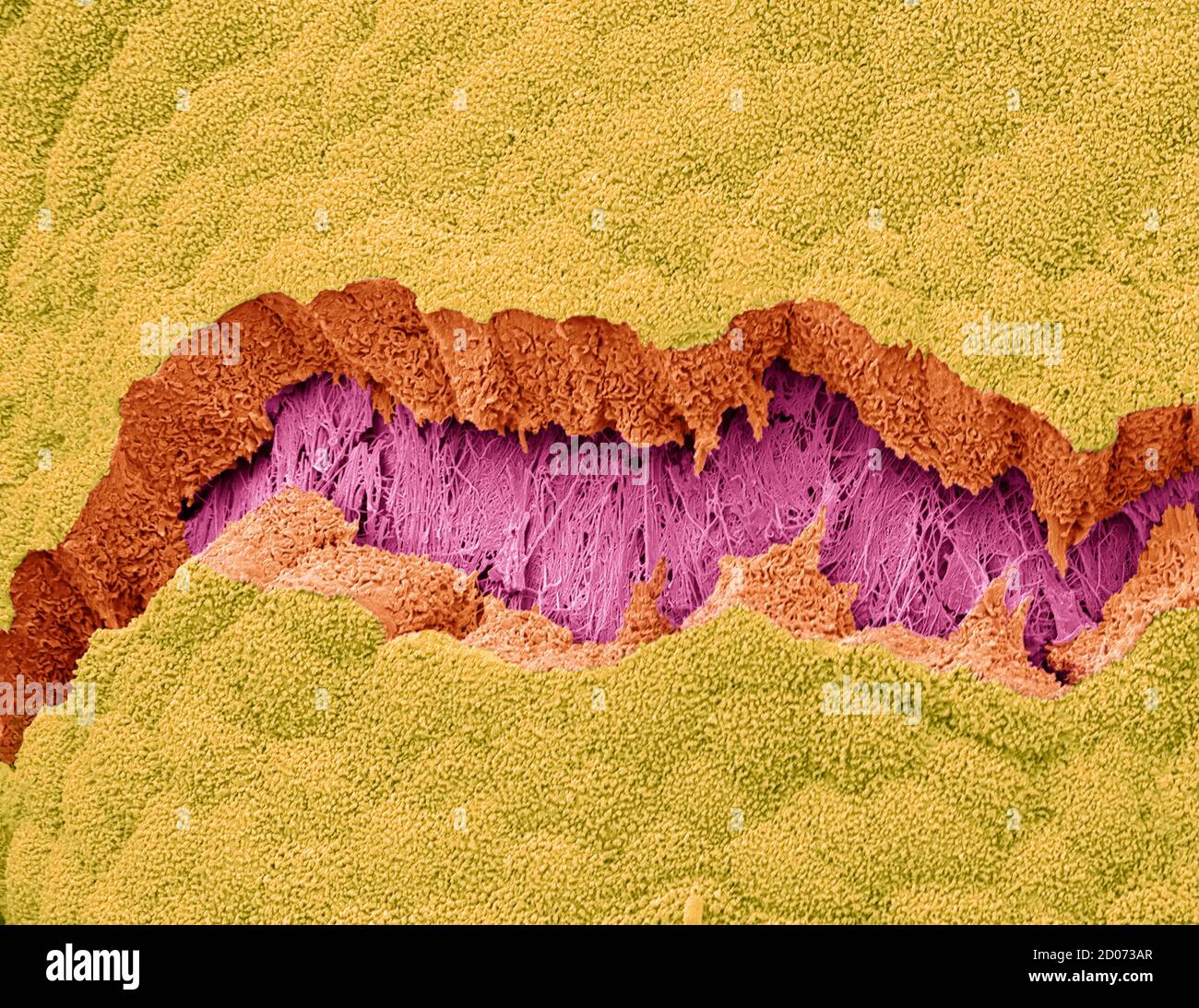 Gall bladder. Coloured scanning electron micrograph (SEM) of the ...