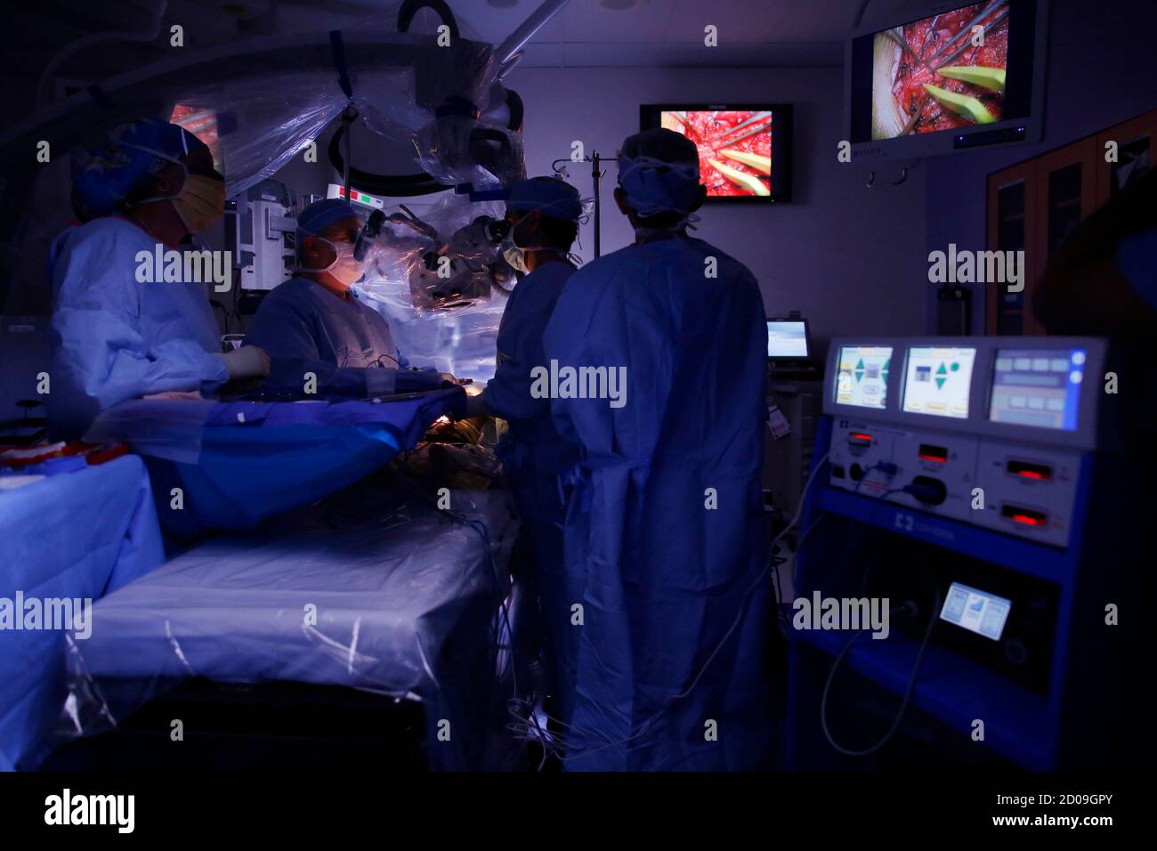 Lipoma of the cord hi-res stock photography and images - Alamy