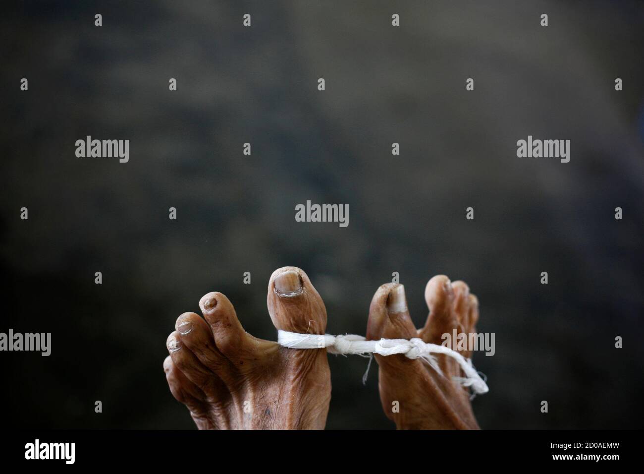 Morgue feet corpse hi-res stock photography and images - Alamy