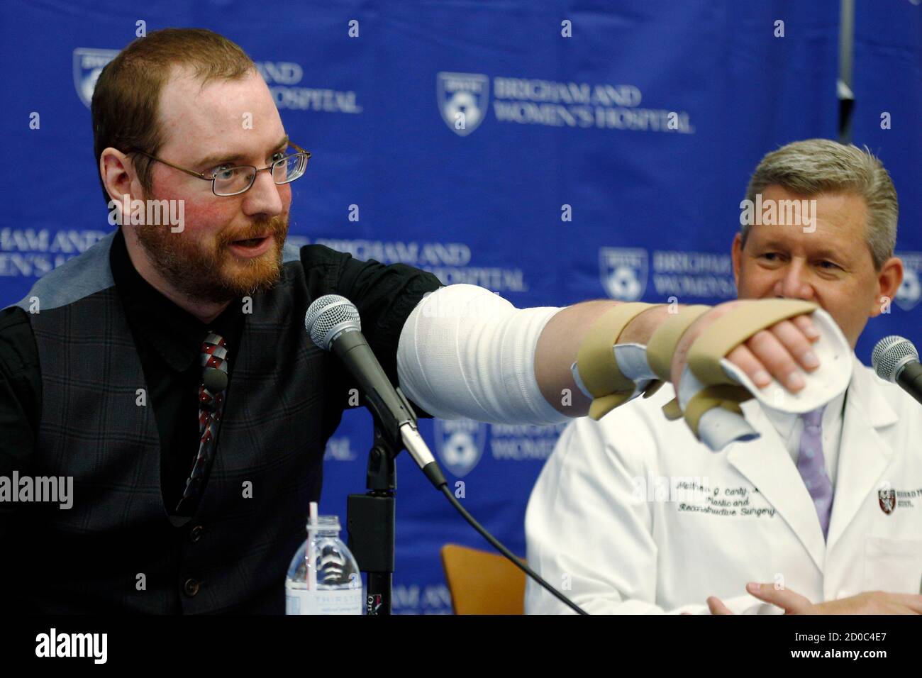 Double arm amputee hi-res stock photography and images - Alamy