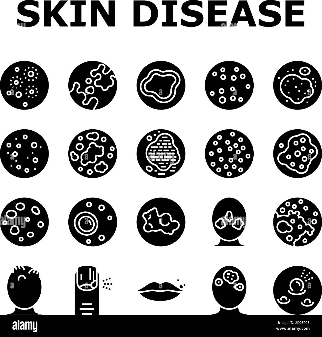Skin Disease Symptom Collection Icons Set Vector Stock Vector Image ...