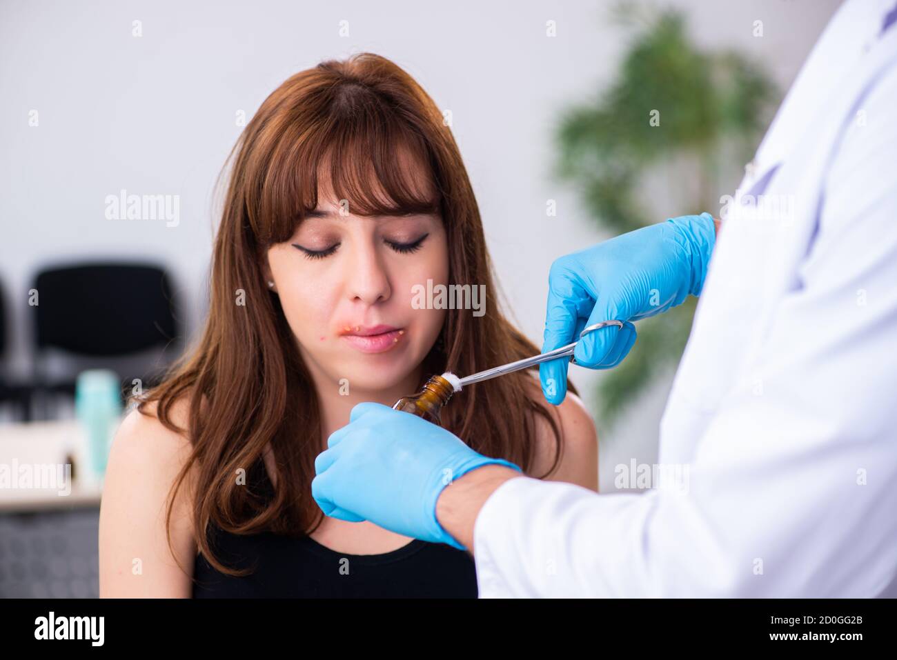 Herpes simplex shingles hi-res stock photography and images - Alamy