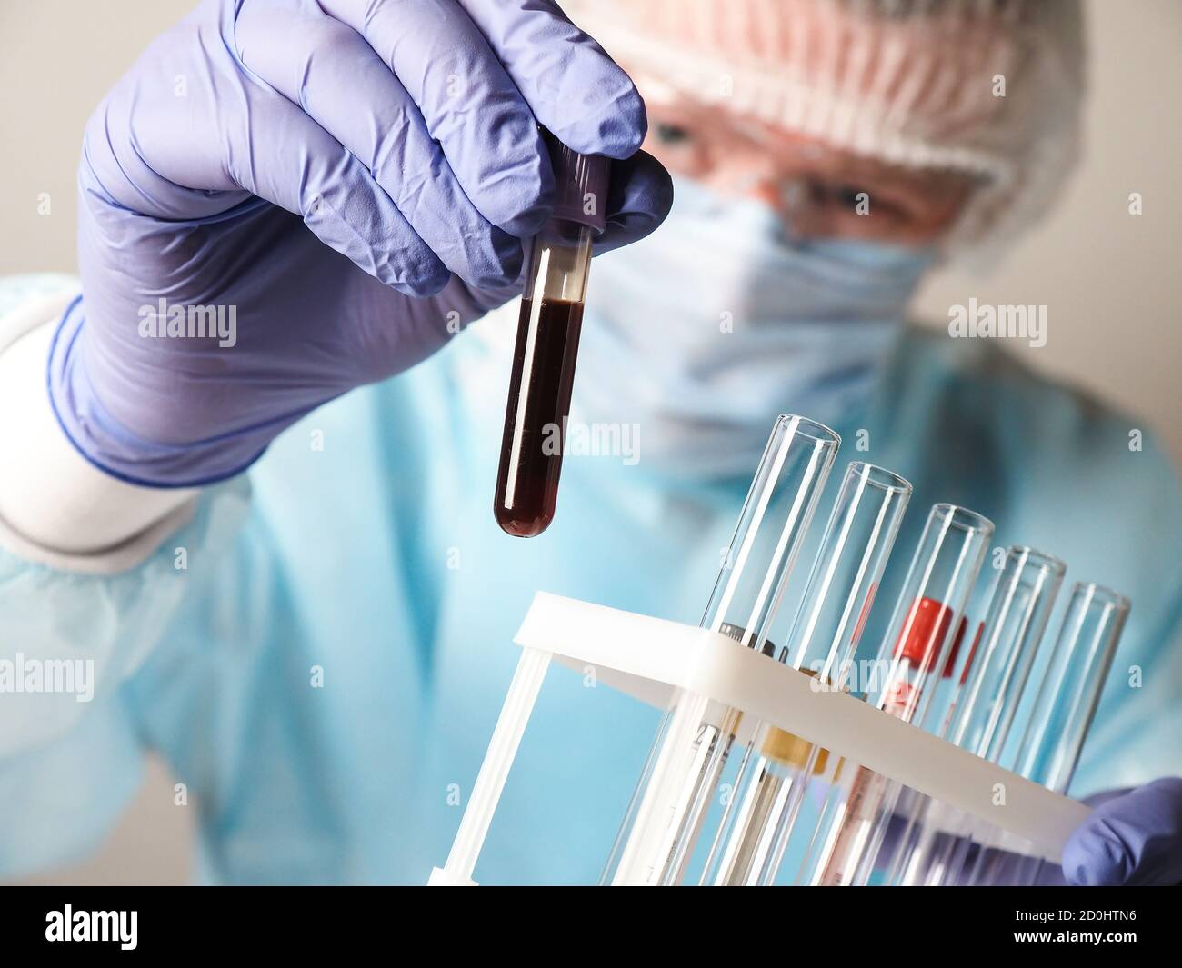 Test tube cap hi-res stock photography and images - Alamy