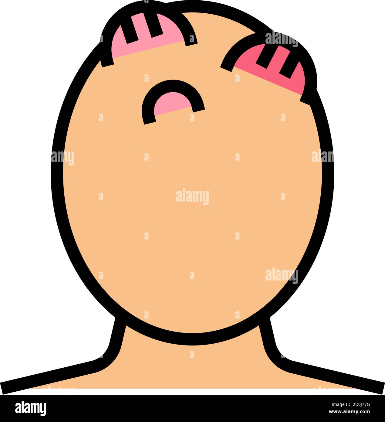 Trichophytosis Skin Disease Color Icon Vector Illustration Stock Vector