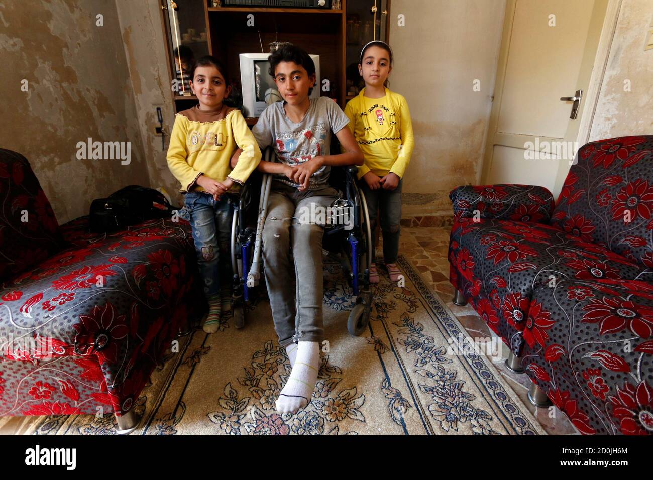 Bone fragmentation hi-res stock photography and images - Alamy