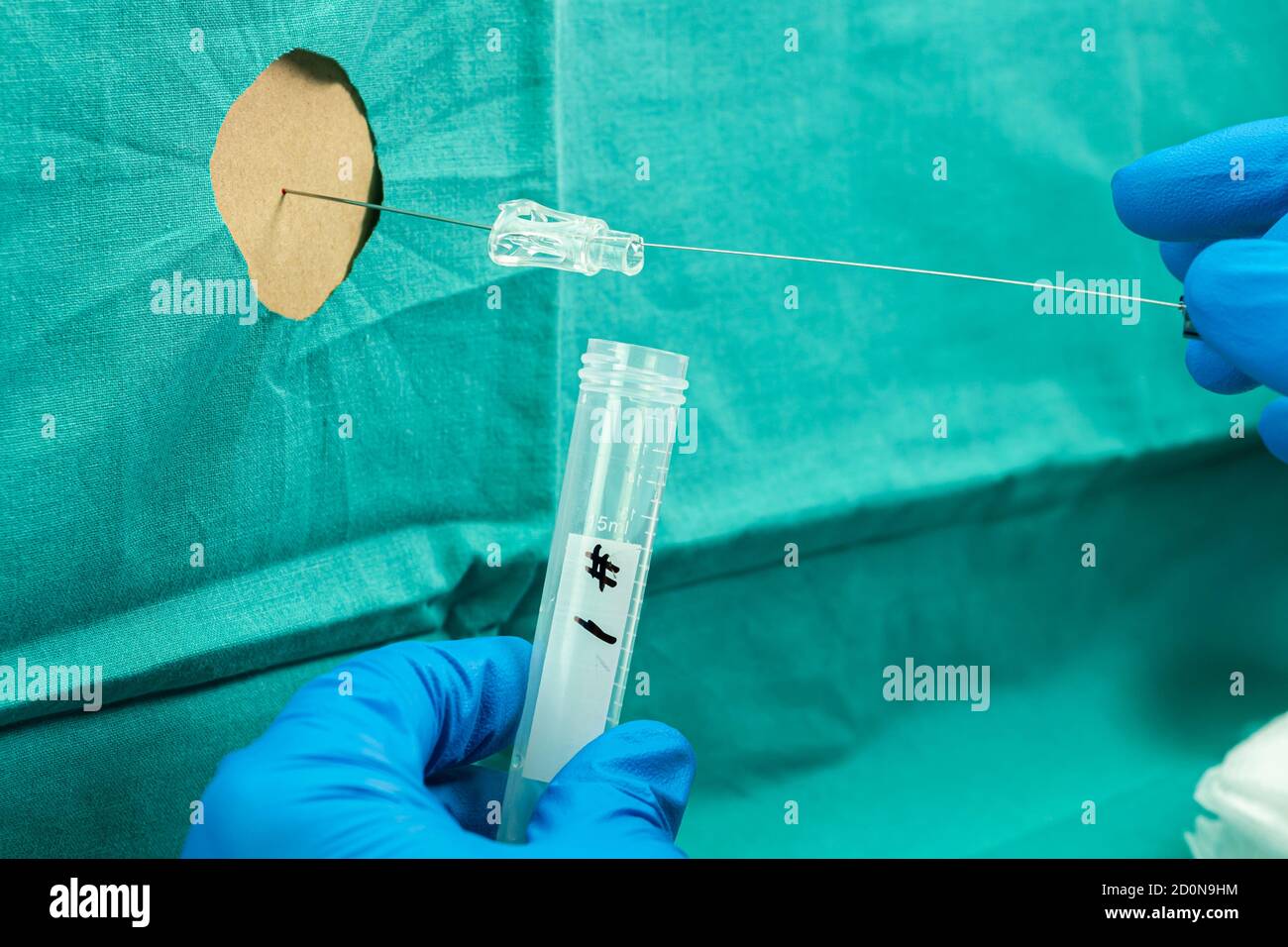Spinal anesthesia hi-res stock photography and images - Alamy