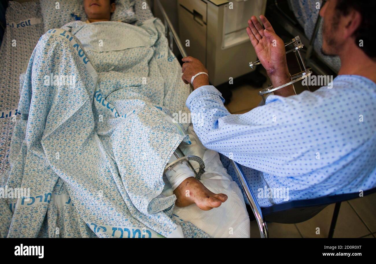 Exploded eyes hi-res stock photography and images - Alamy