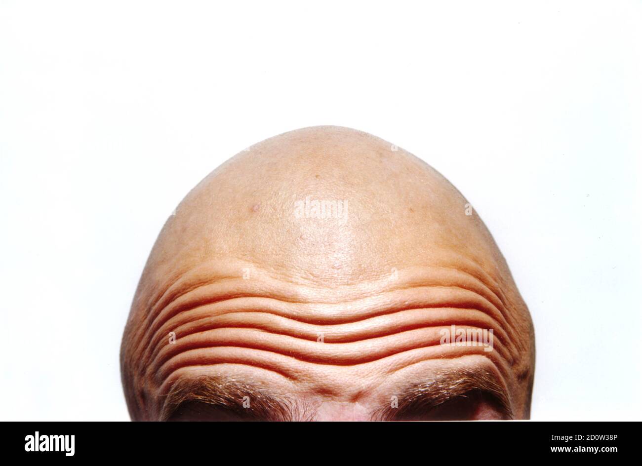 Head wrinkles hi-res stock photography and images - Alamy