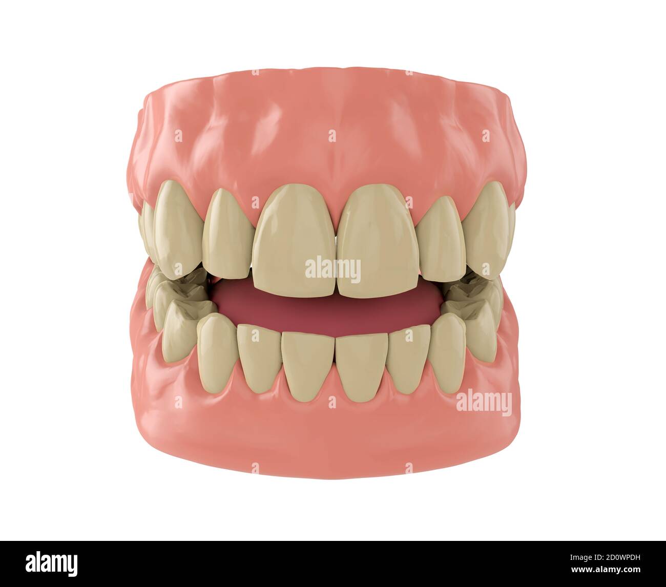 Yellow teeth hi-res stock photography and images - Alamy