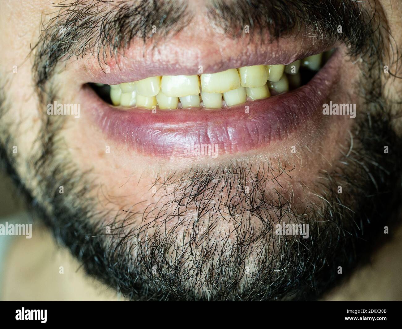 Male smiling mouth with yellowed teeth. Closeup photo Stock Photo - Alamy