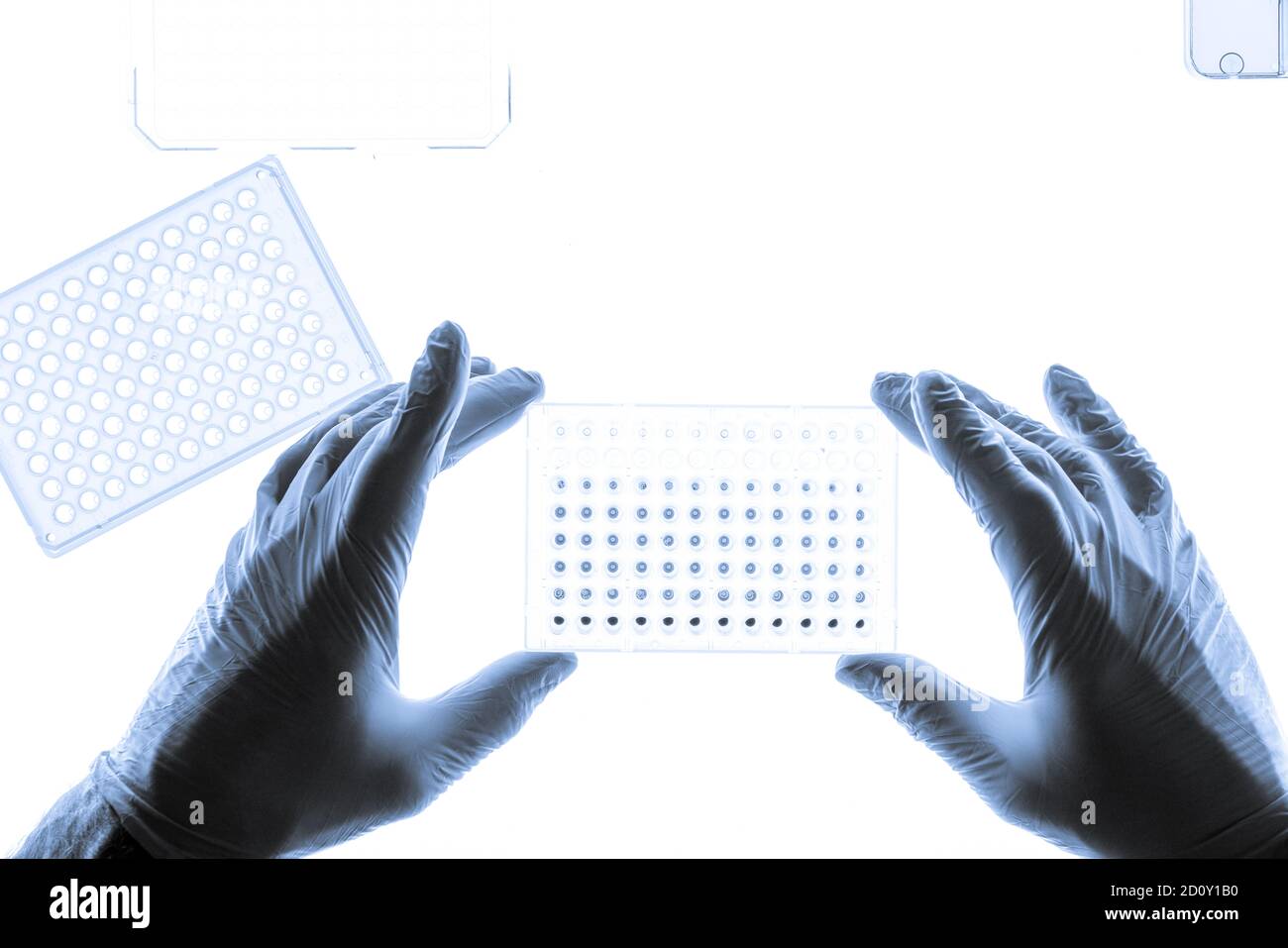 Dna Samples Are Loaded To 96-Well Plate For Pcr Analysis Stock Photo ...