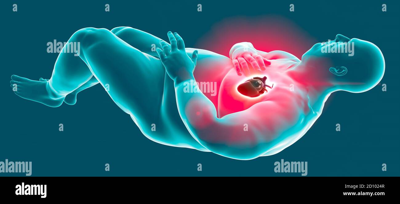 Fat man, heart attack. Man lying on the ground. Heart problems ...