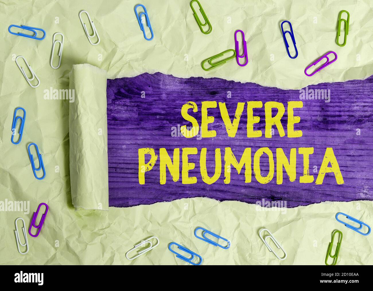 Handwriting text writing Severe Pneumonia. Conceptual photo acute ...