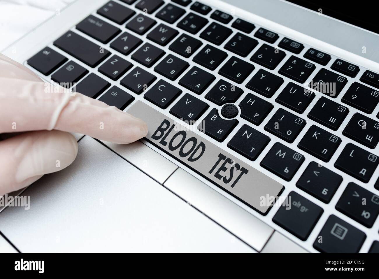 Writing note showing Blood Test. Business concept for Extracted blood ...