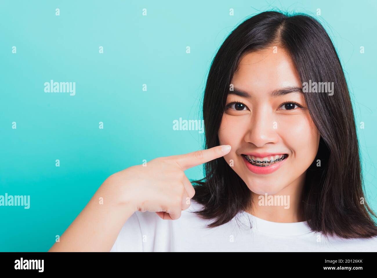 Cute teen girl crooked teeth hi-res stock photography and images - Alamy