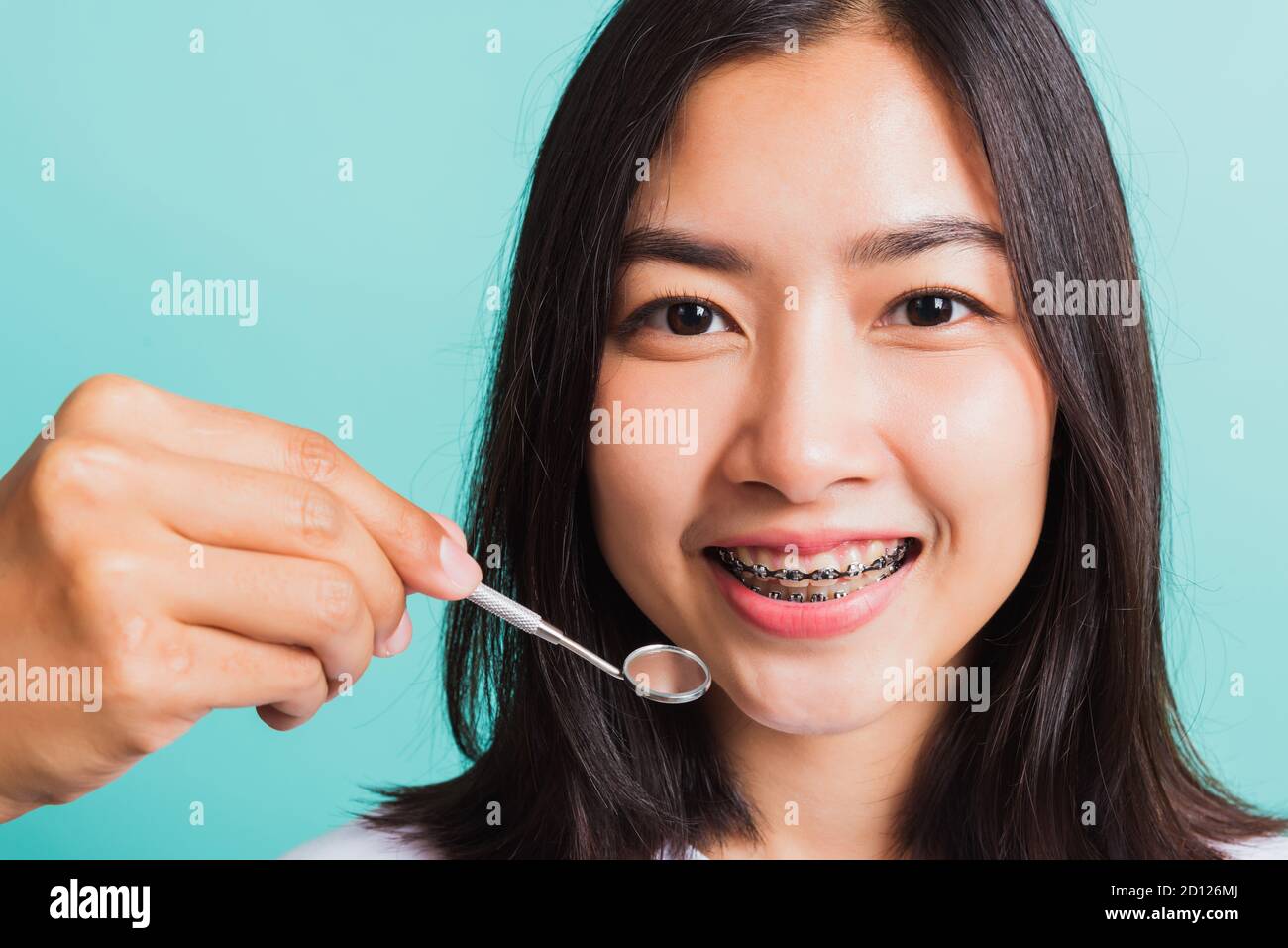 Asian teen beautiful young woman smile have dental braces on teeth ...