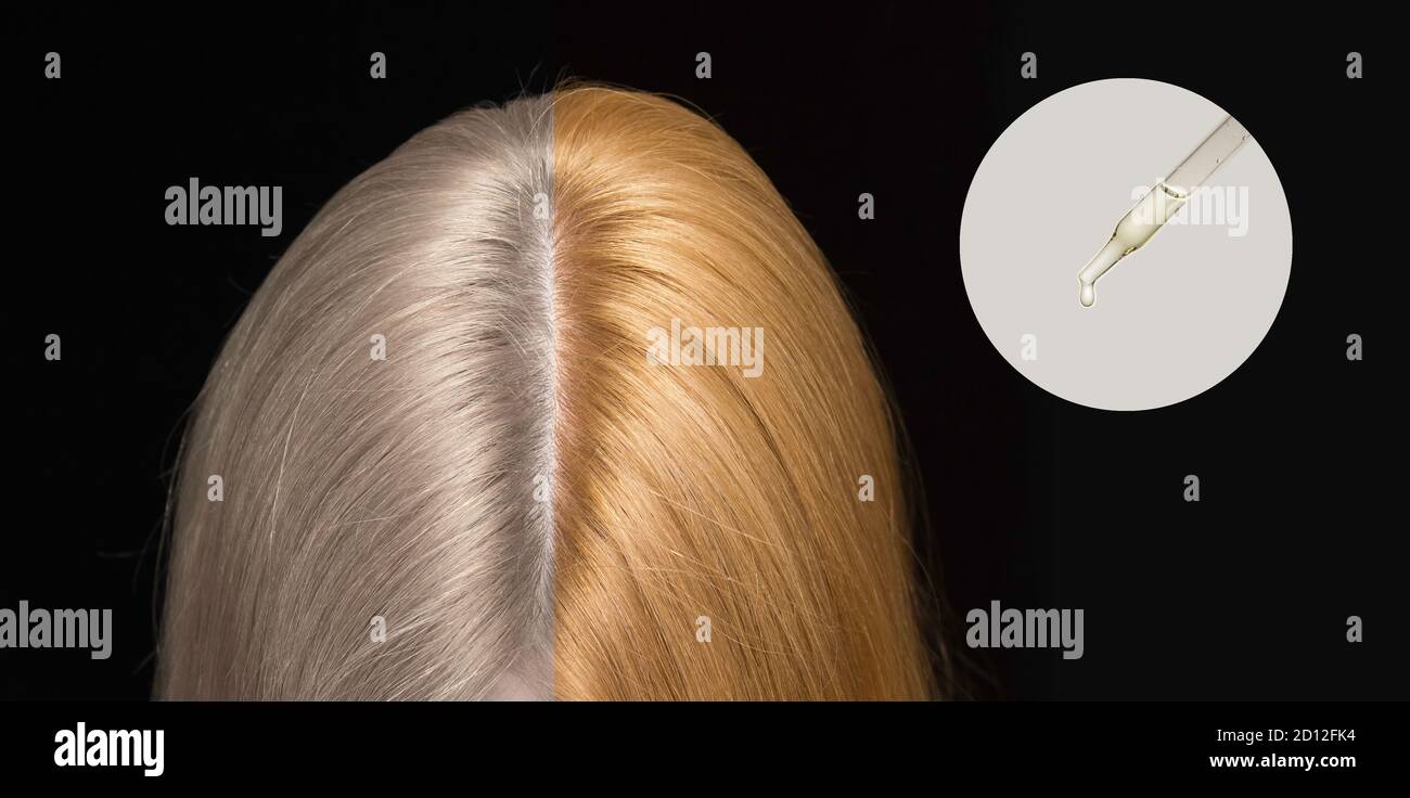 Pipette with cosmetic oil in a circle. Textures of colorless and ...