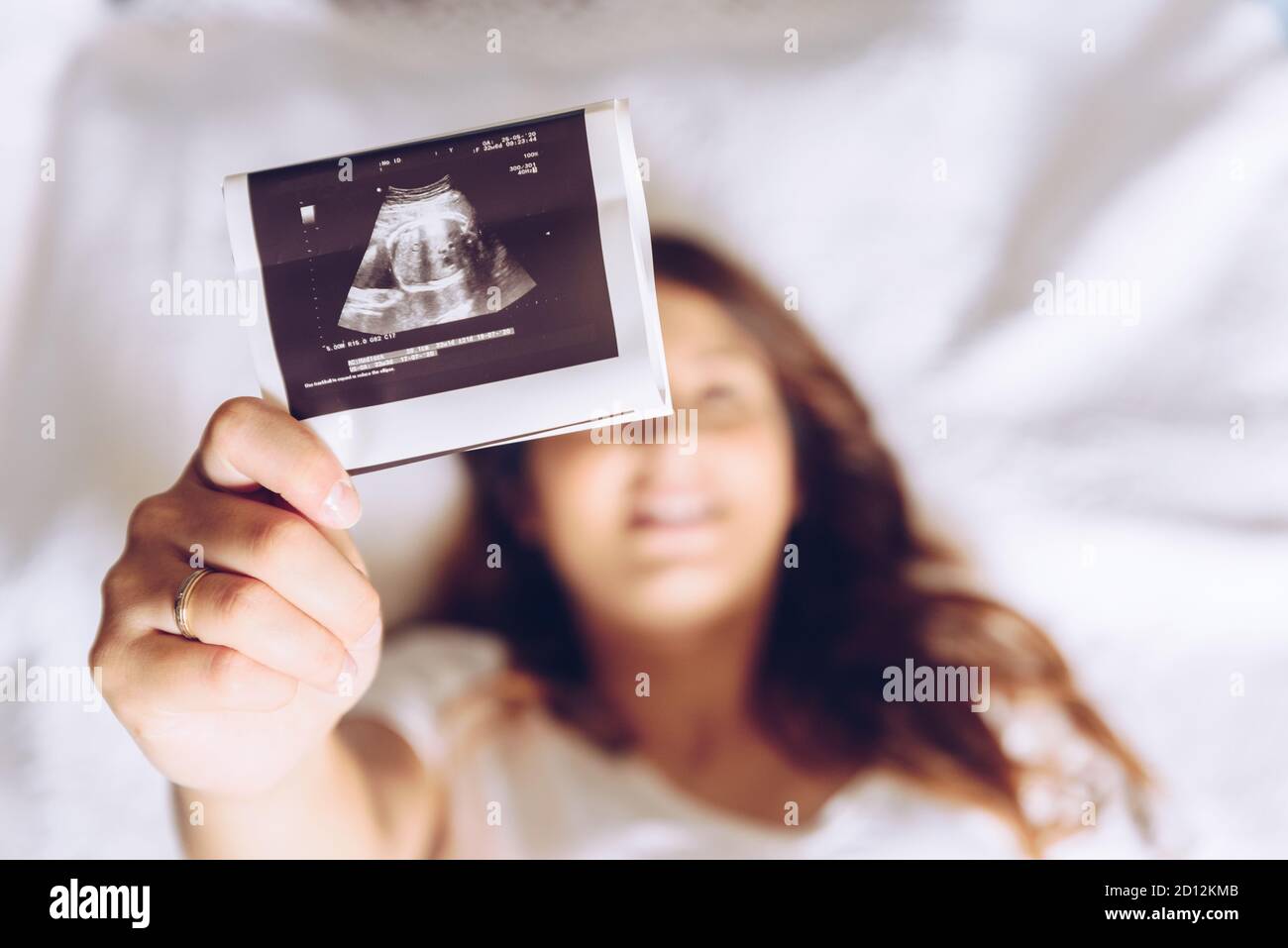 Top scan hi-res stock photography and images - Alamy