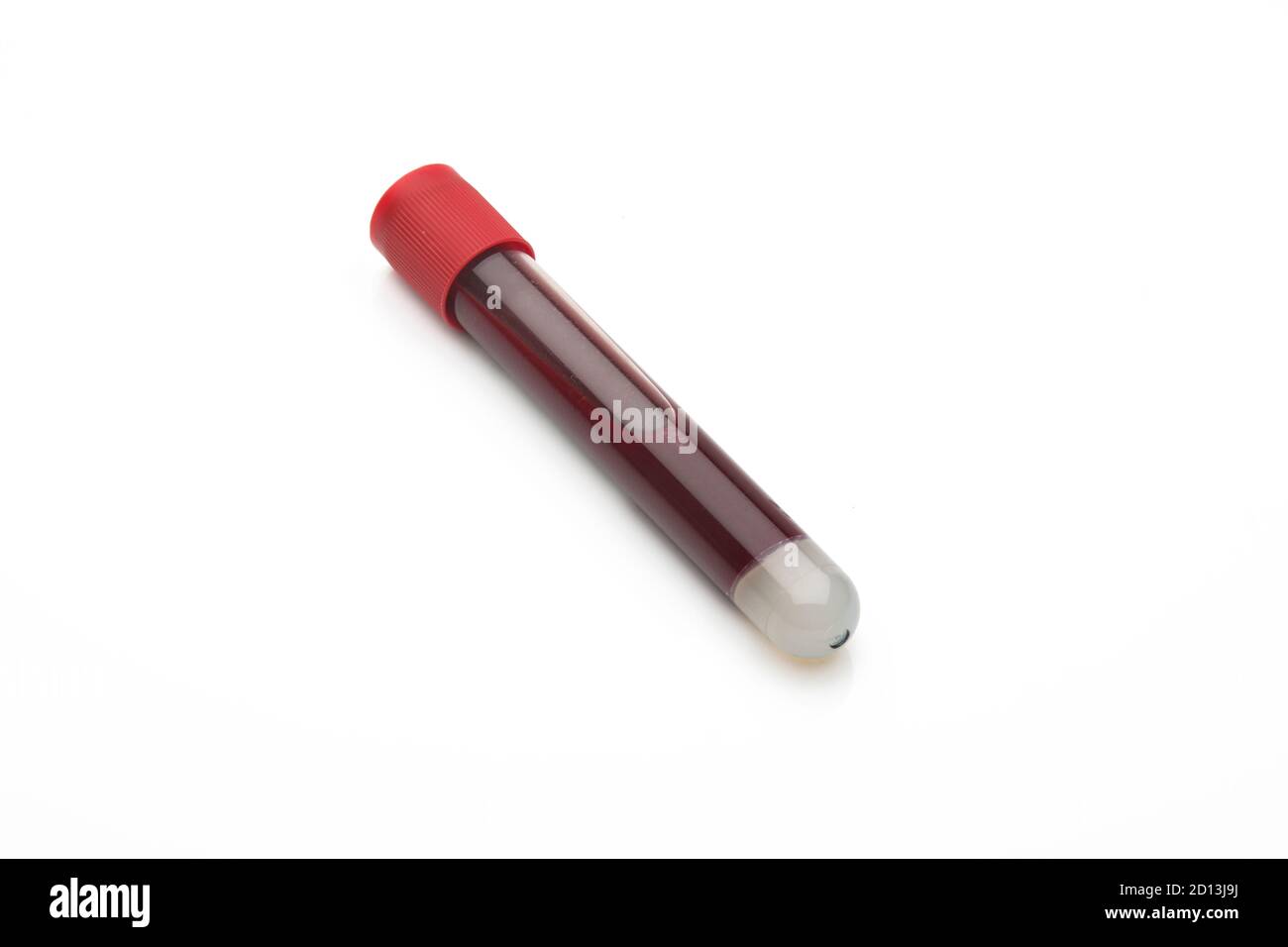 test tube with blood isolated on white background Stock Photo - Alamy
