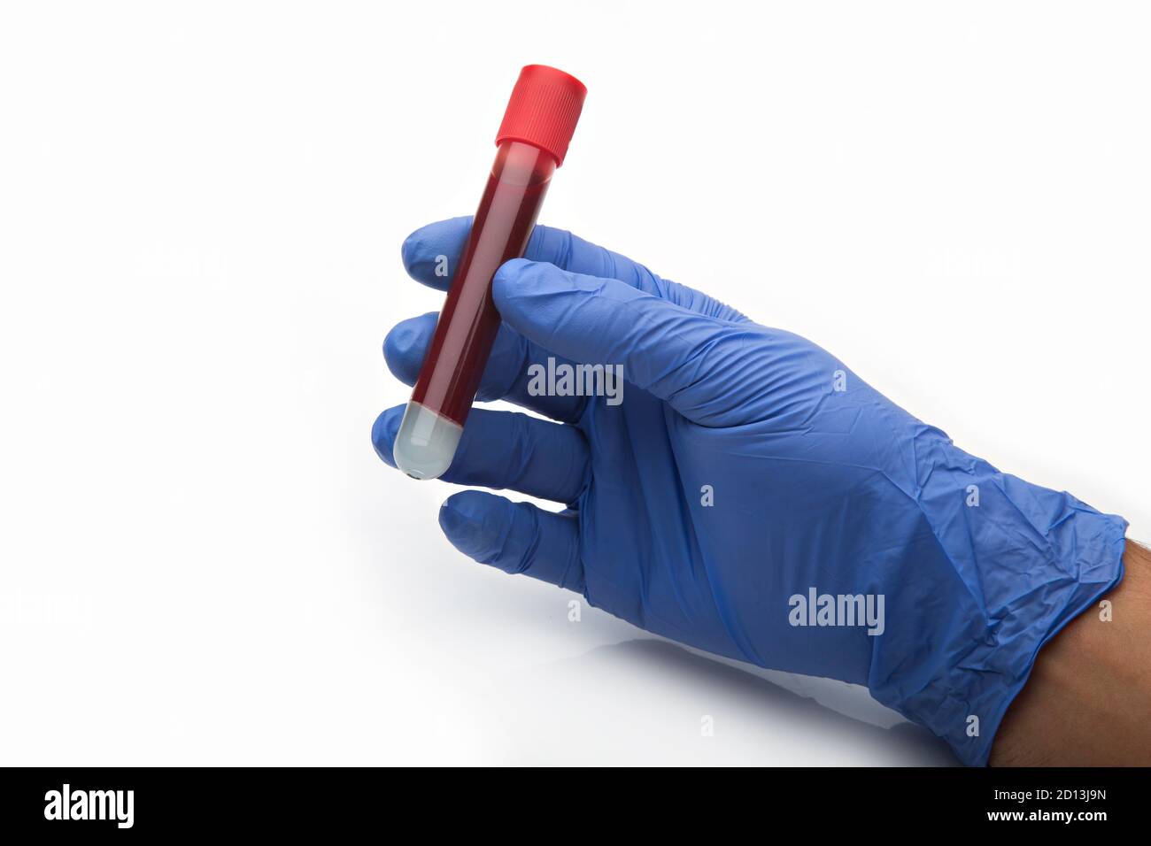 Hand holding test tube with blood isolated on white background Stock ...