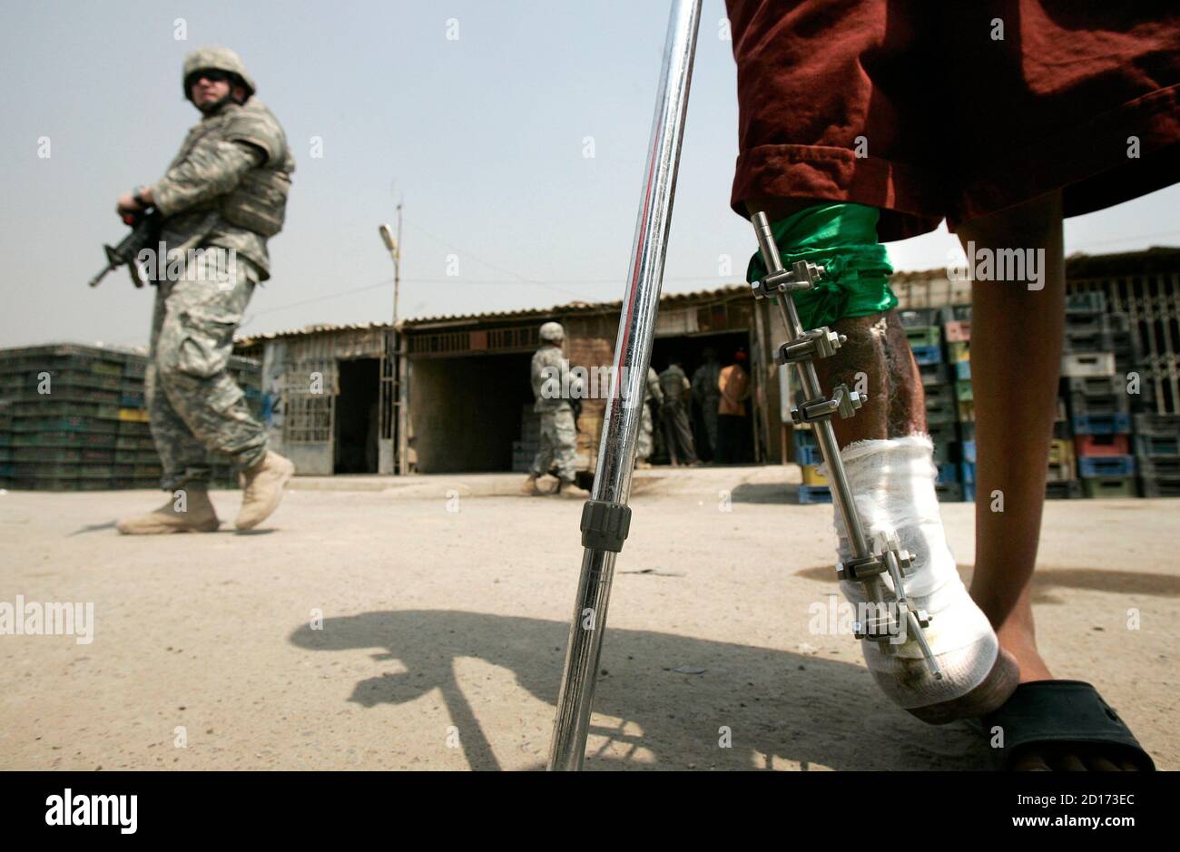 Civil war amputee soldier hi-res stock photography and images - Alamy