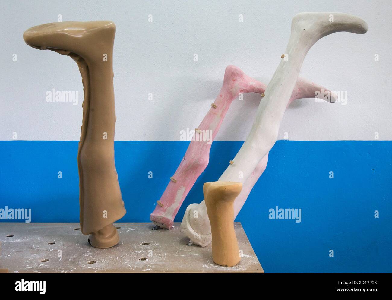 Plaster leg cast legs hi-res stock photography and images - Alamy