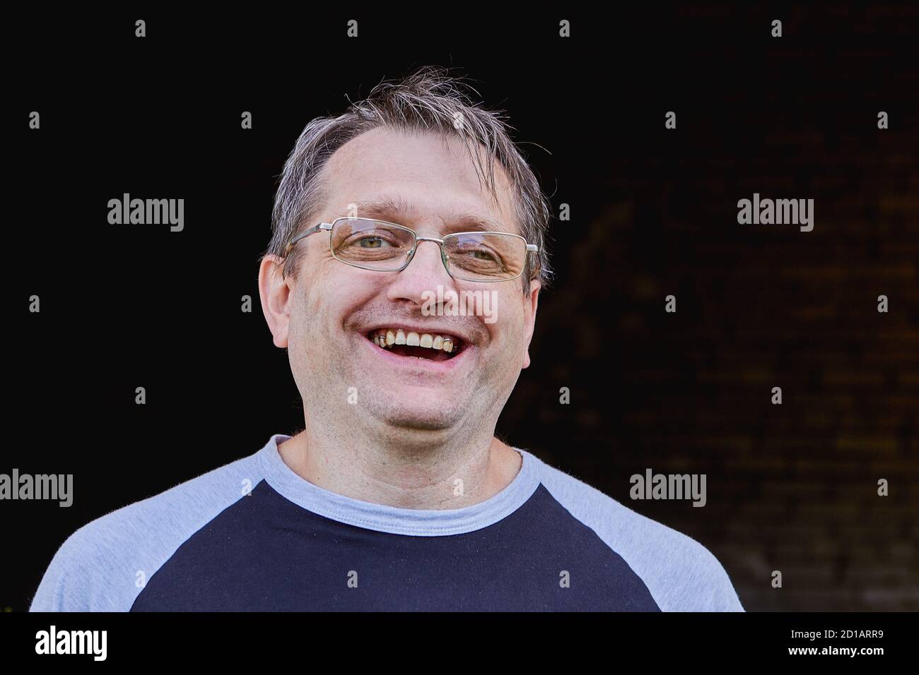 portrait of an adult male face, strabismus or exotropia Stock Photo - Alamy