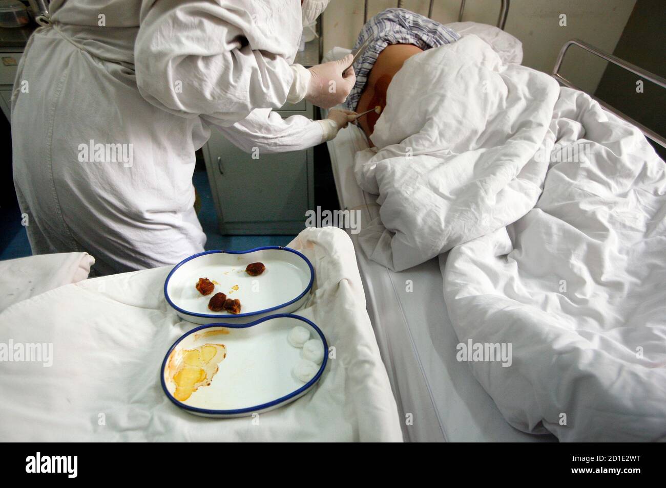 Aids patient hospital bed hi-res stock photography and images - Alamy