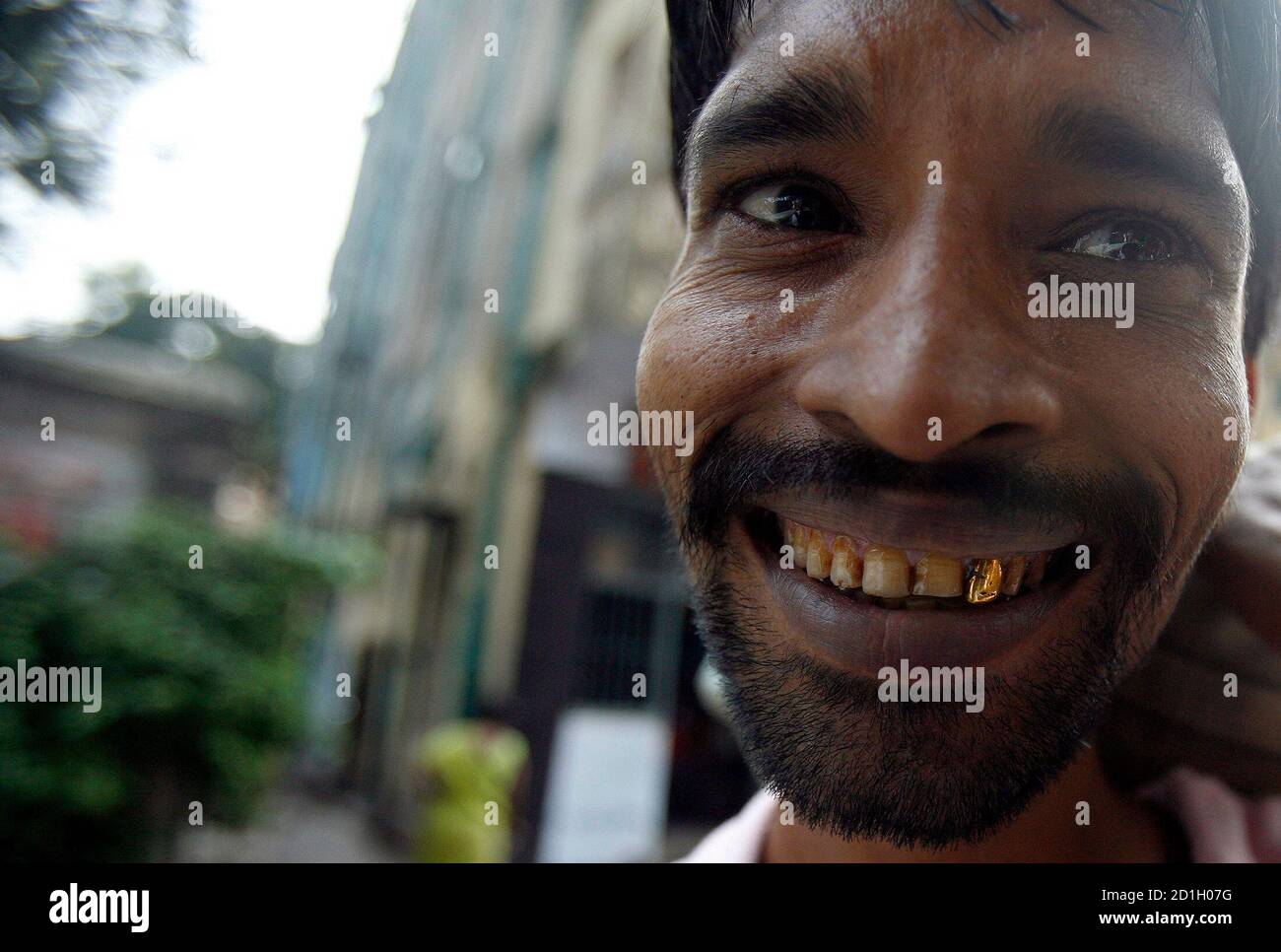 Gold tooth india hi-res stock photography and images - Alamy