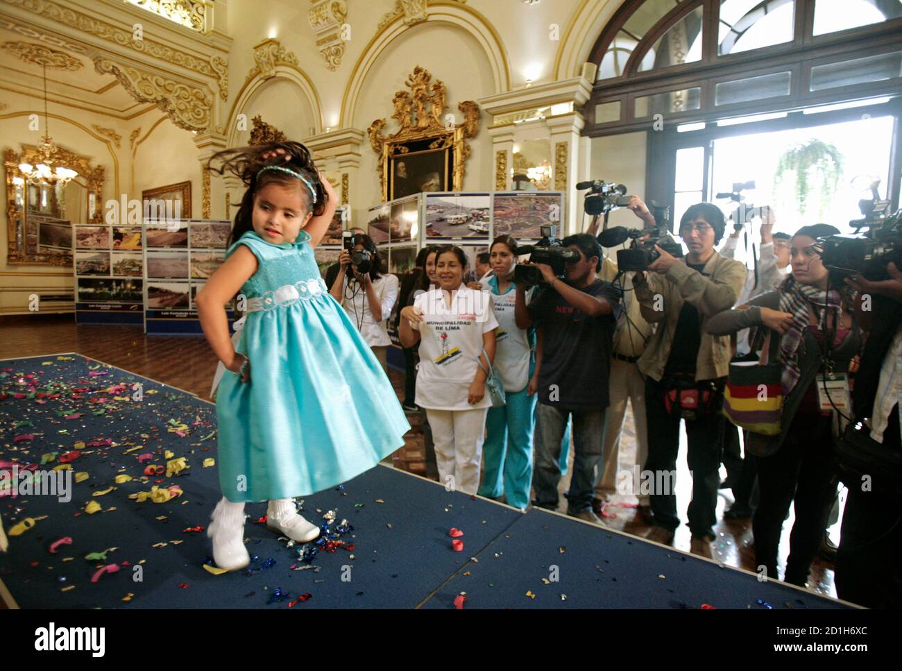 Hand birth defect hi-res stock photography and images - Alamy