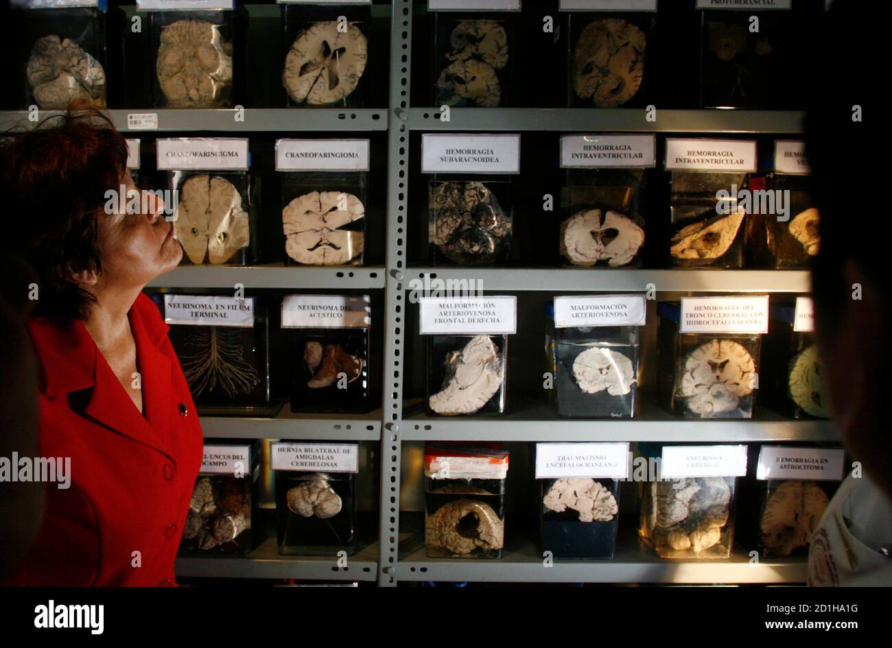 Brain Specimens High Resolution Stock Photography and Images - Alamy