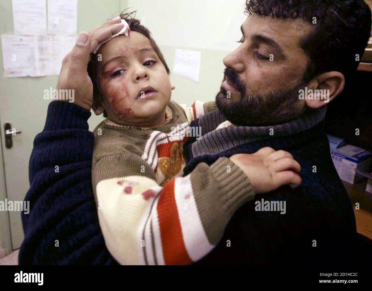 From shrapnel hi-res stock photography and images - Alamy