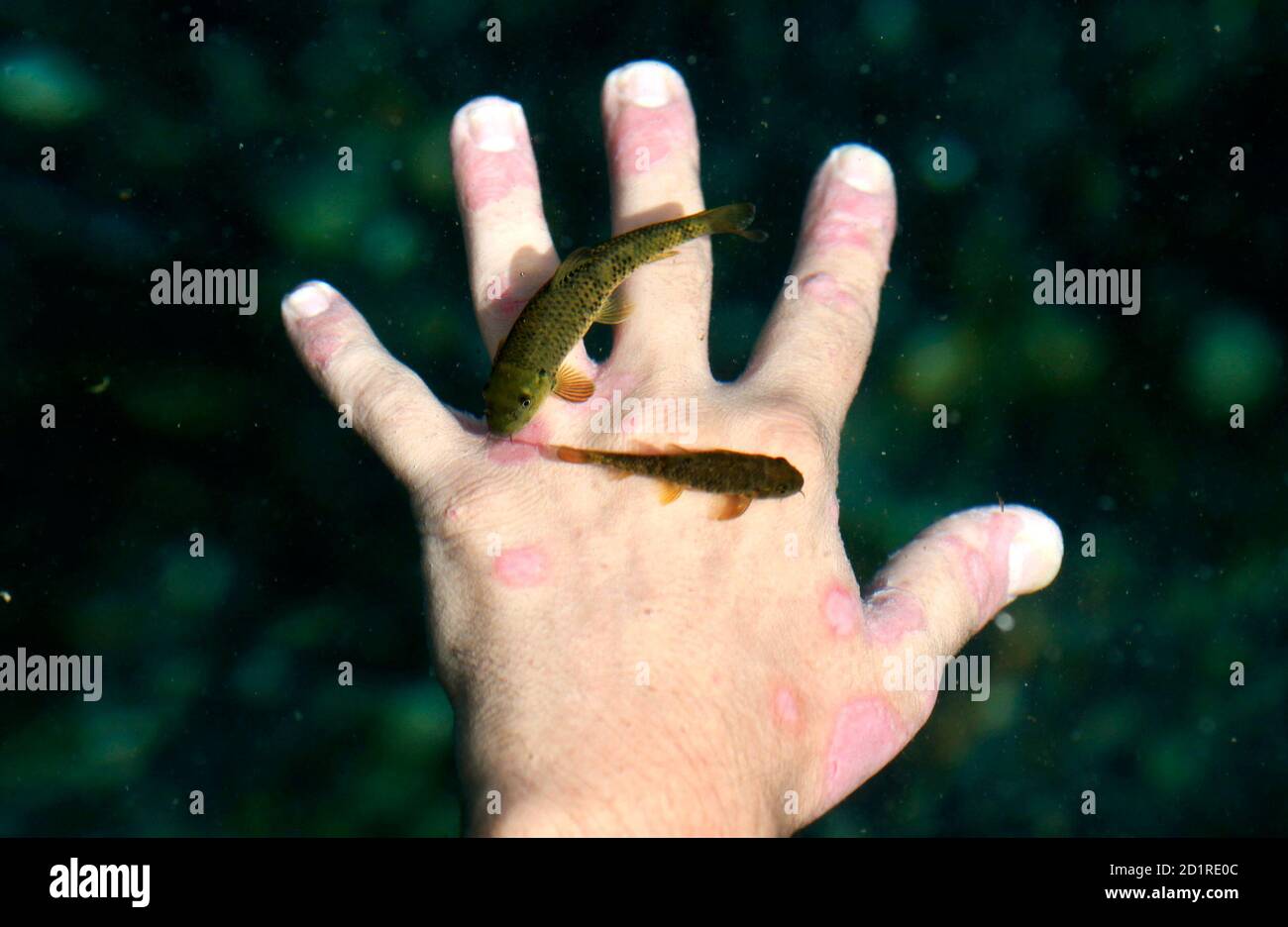 Psoriasis fish hi-res stock photography and images - Alamy