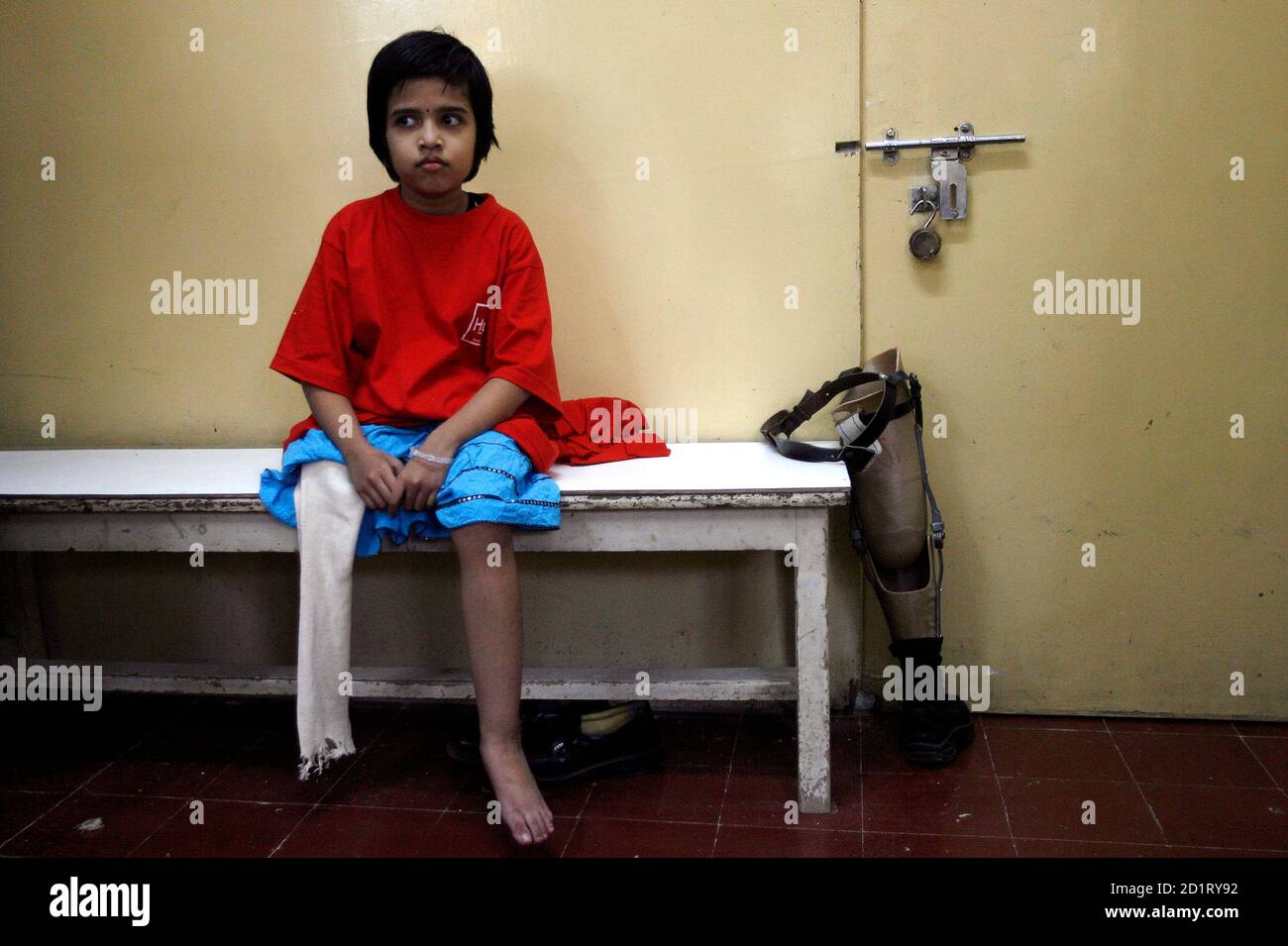 Human deformity hi-res stock photography and images - Alamy