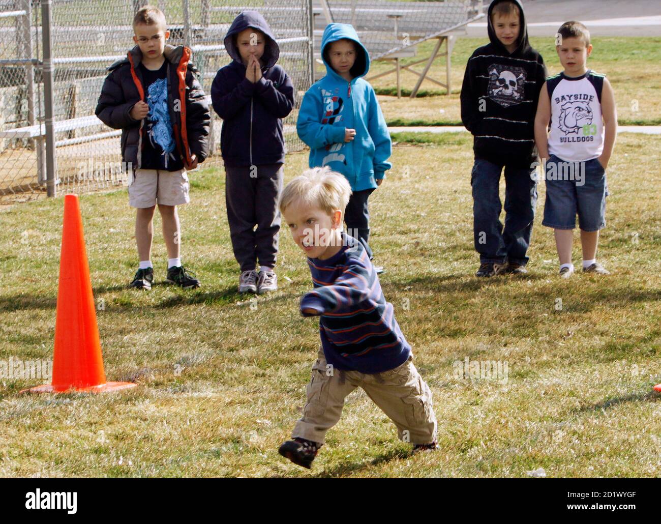 Achondroplasia Dwarfism High Resolution Stock Photography and Images ...