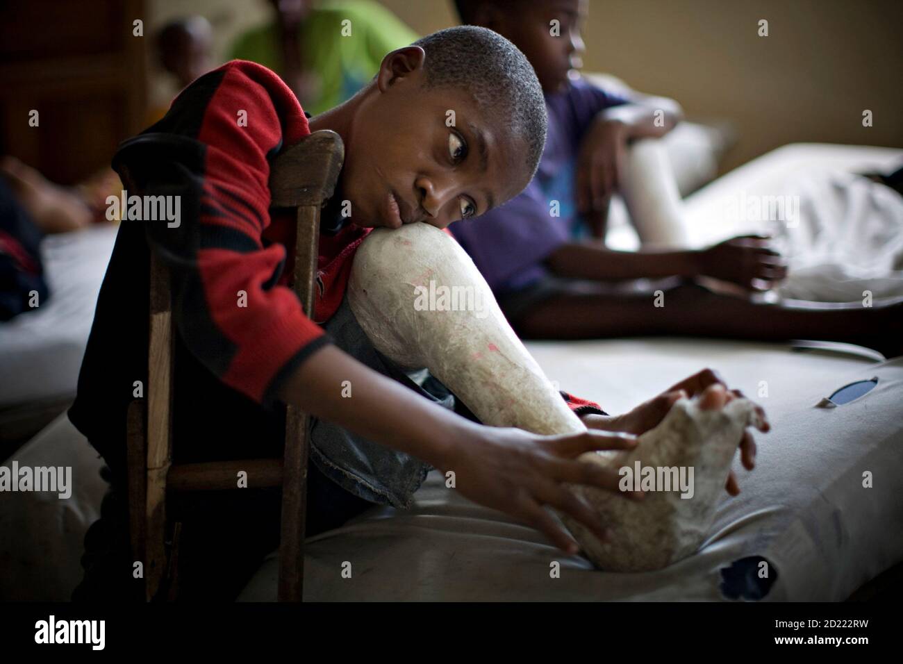 Boy child with leg in cast hi-res stock photography and images - Alamy