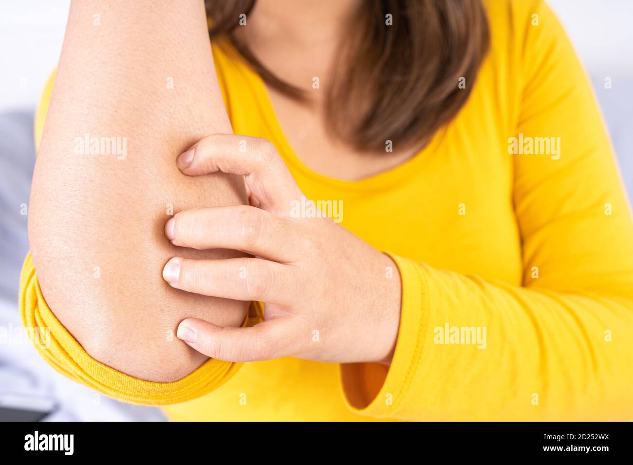 Female scratching her arm on white background with copy space. Medical ...