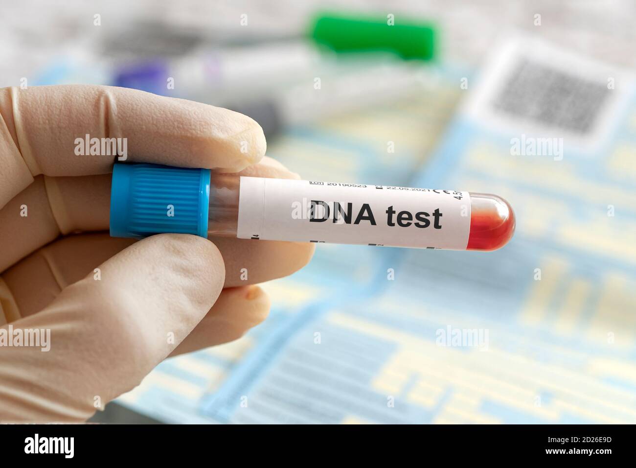 DNA test lettering on a white label. DNA blood test in the hand of a ...