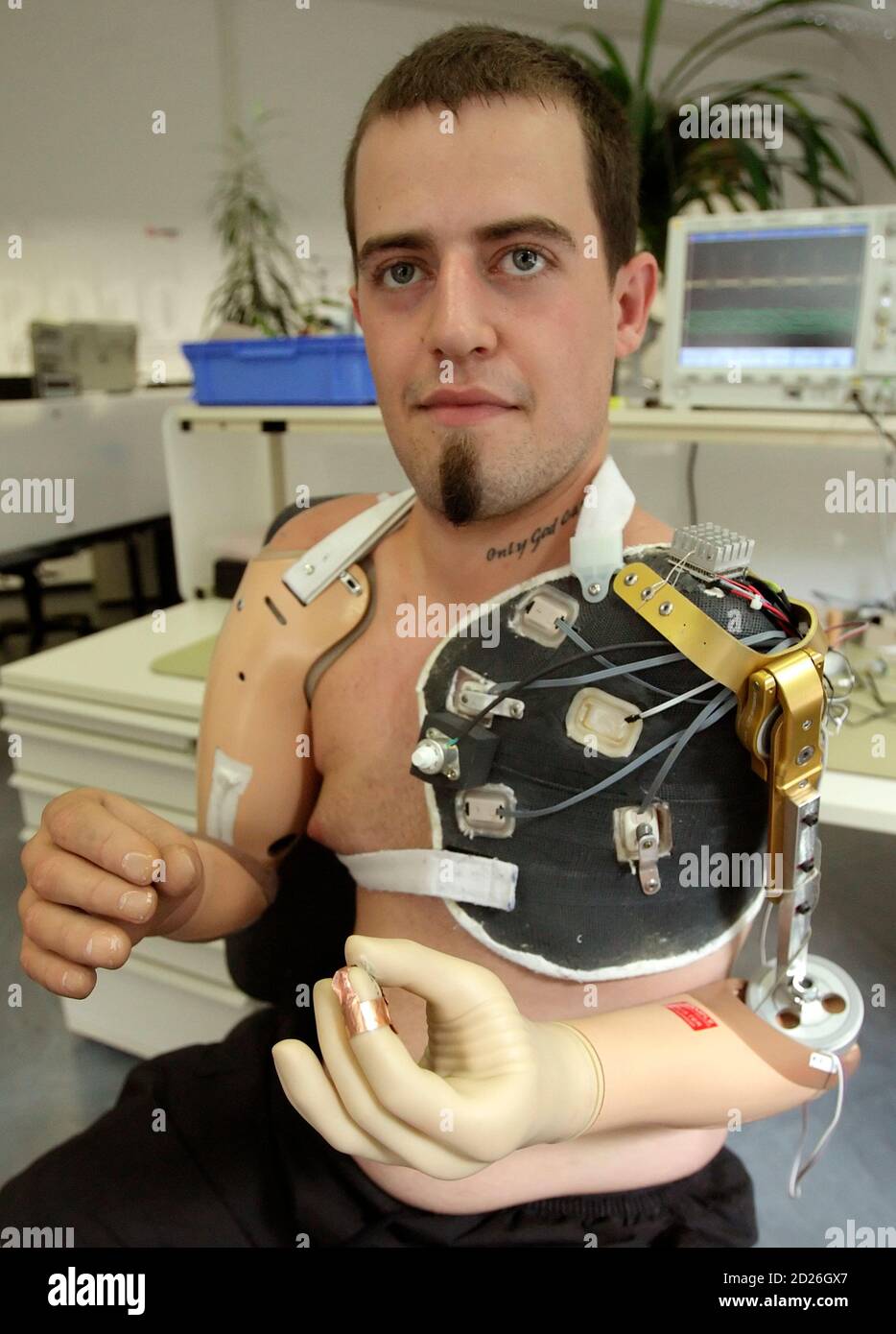Pictures of prosthetic arms hi-res stock photography and images - Alamy