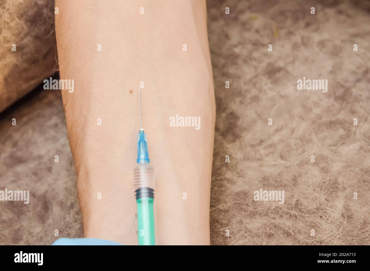 Allergy skin test injection hi-res stock photography and images - Alamy