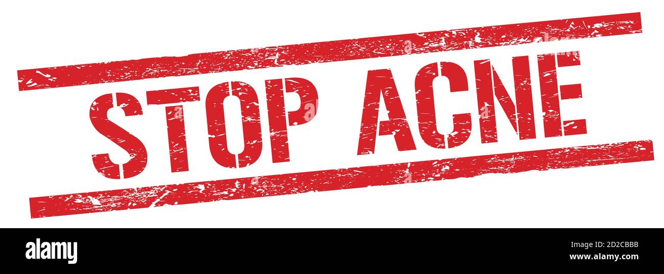 STOP ACNE text on red grungy rectangle stamp sign Stock Photo - Alamy