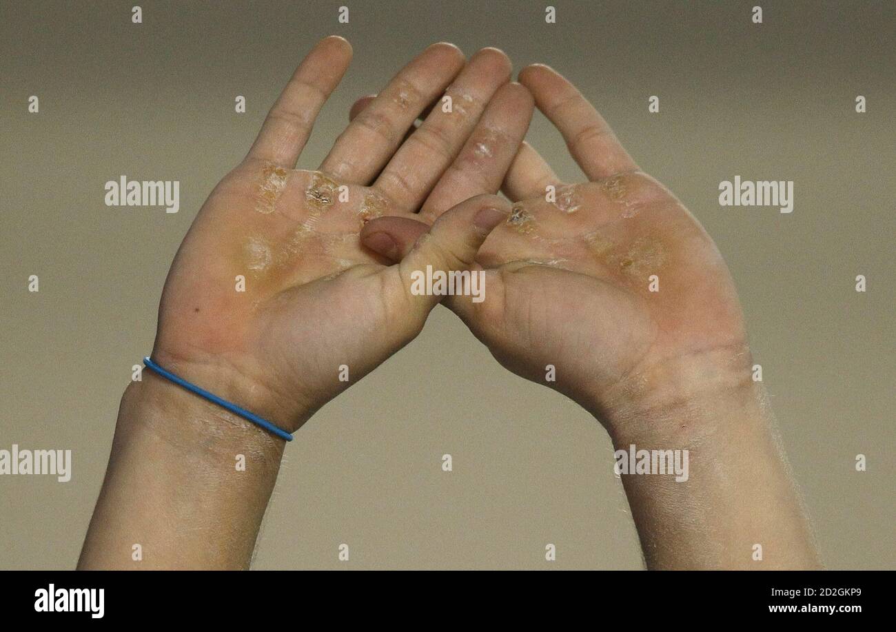 Calloused hands hi-res stock photography and images - Alamy