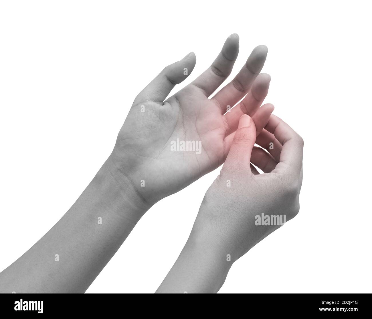 Image of a sore hand. Black and white female hand with pain points ...