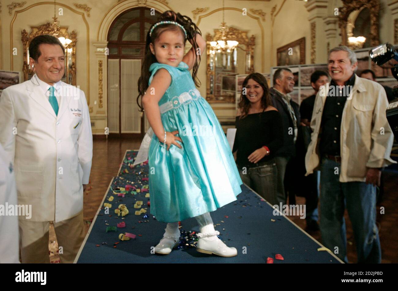 Hand birth defect hi-res stock photography and images - Alamy